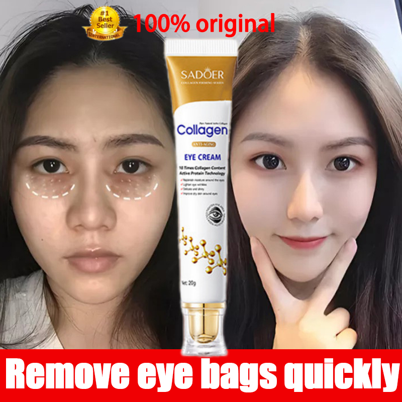 Eye cream 20g dark circles milia seed removal Eyebag Remover Aging ...