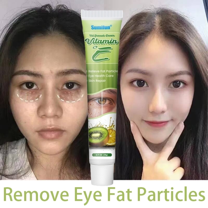 20g Fat Granule Cream Vitamin E Milia Seed Remover Eye Cream Syringoma ...
