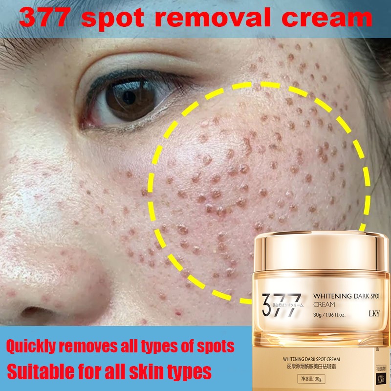 melasma cream freckles removal cream centella pigmentation dark spot ...