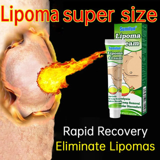 Lipoma Cream 20g Removing Lumps in the Body Lymph Nodes Multiple Single ...