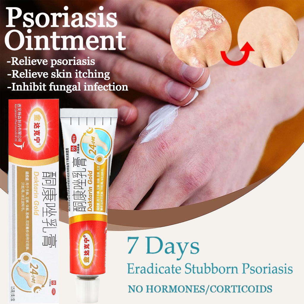 15g Daktarin Gold Kninkone Cream 15g Treatment Athlete's Foot Ointment ...