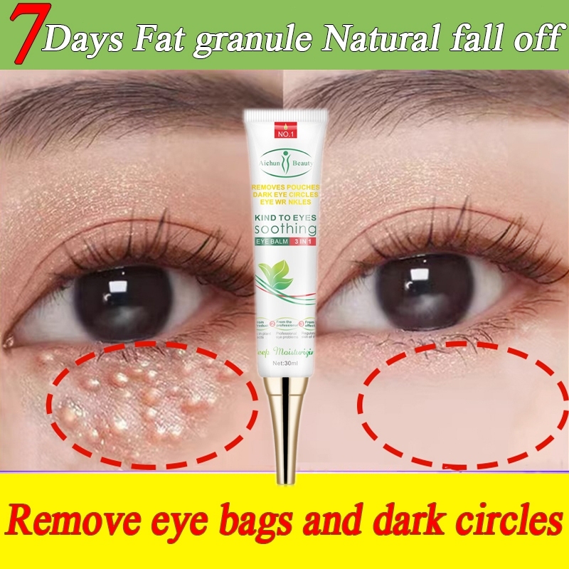 Removal Eye Cream Remove Eye Bags Dark Eye Circles Eye Wrinkles Fat ...