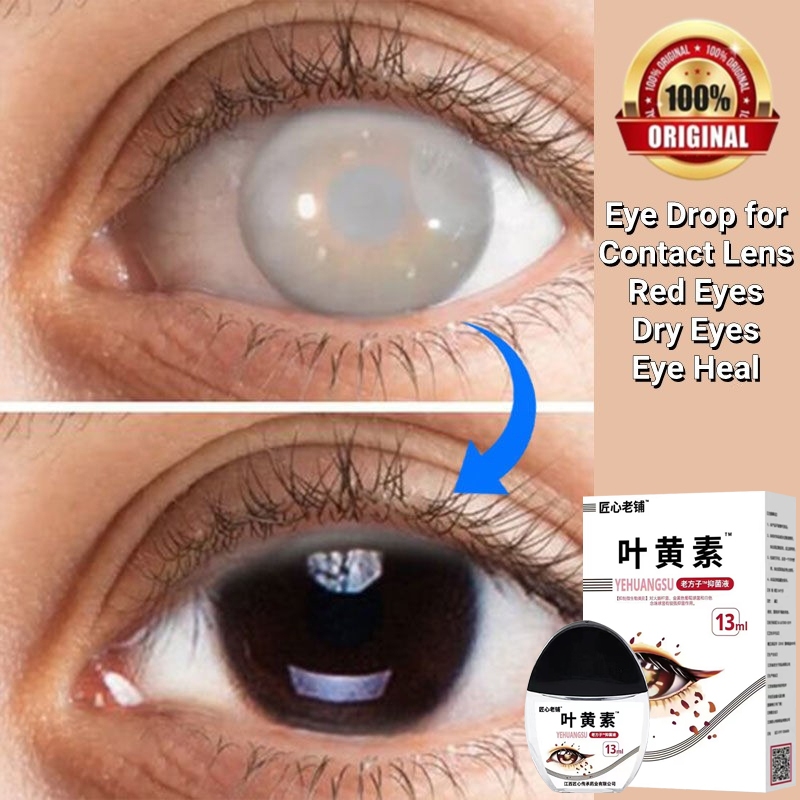 lutein eye supplement/lutein eye drops/eye drop-Lutein relieves dry eye ...