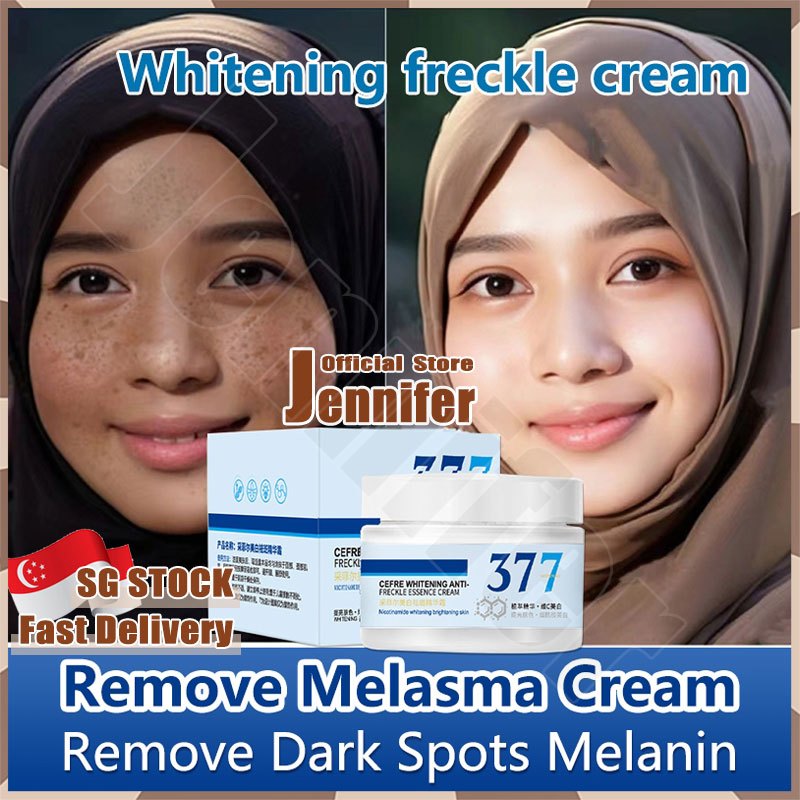 💥𝗦𝗚 𝗦𝗧𝗢𝗖𝗞💥 𝙊𝙧𝙞𝙜𝙞𝙣𝙖𝙡 377 whitening cream / 50g Freckles removal cream ...