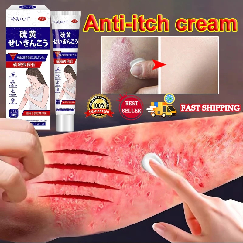 anti itch antifungal cream 止癢膏 anti viral relief itchy redness peeling relief eczema skin sulfur ...