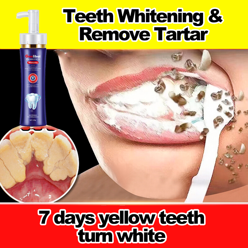 [SG STOCK] Whitening toothpaste Remove tooth stains yellow Sensitive ...