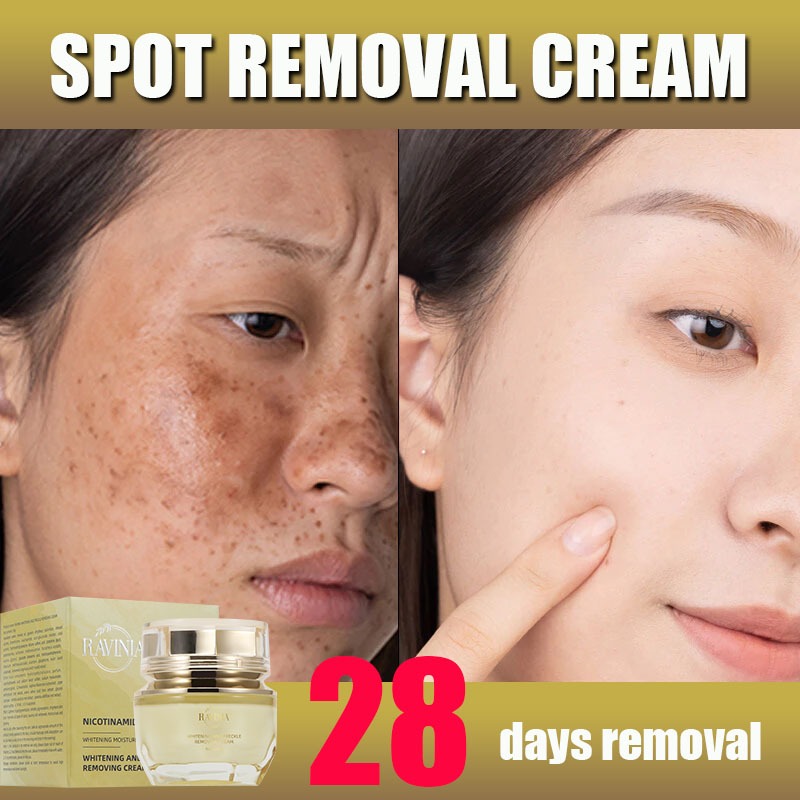 Freckles removal cream Dark spot cream Whitening cream 30g Remove ...