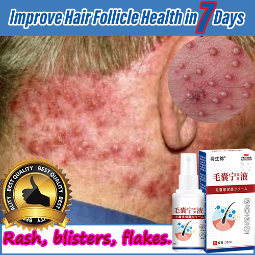 Folliculitis medicine, medicine for folliculitis, scalp acne medicine ...