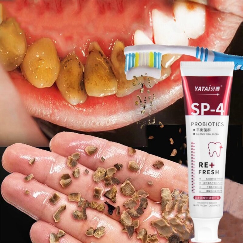 SP4 Teeth whitening Probiotic Toothpaste yatai toothpaste 120g ...