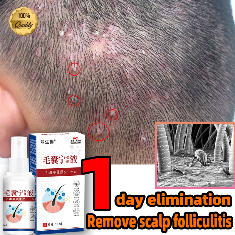 Treat folliculitis itchy red swollen,hair care scalp serum pustules ...