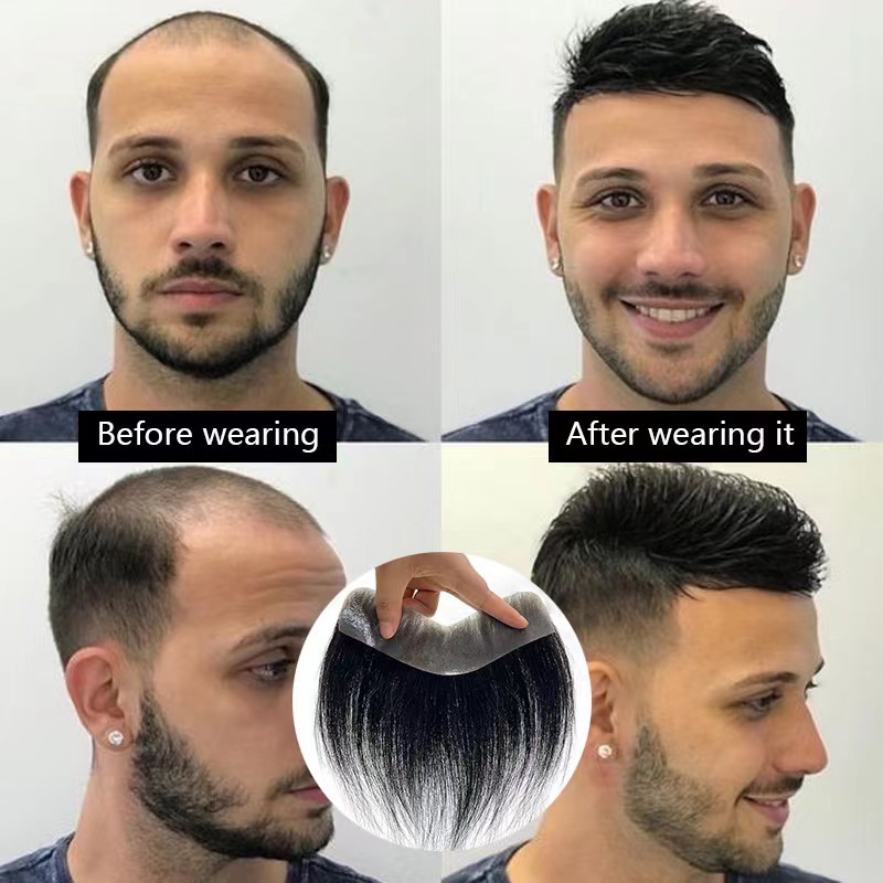 Wig piece Men and women forehead fake bangs M-shaped hairline fake hair ...