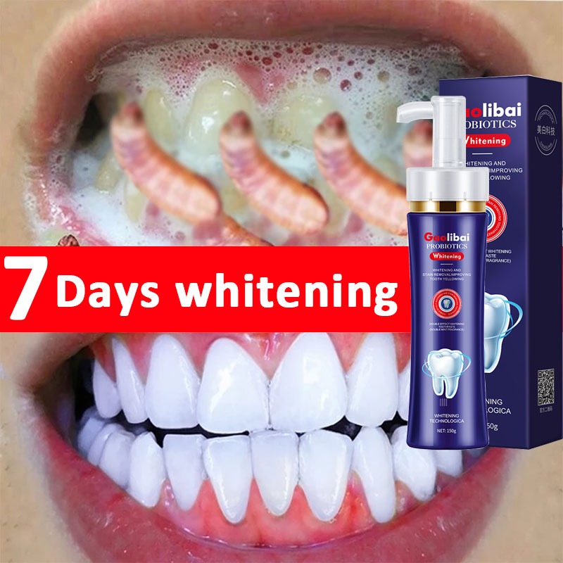 Probiotic toothpaste, Solve tooth stains, yellow teeth, tartar, tooth ...