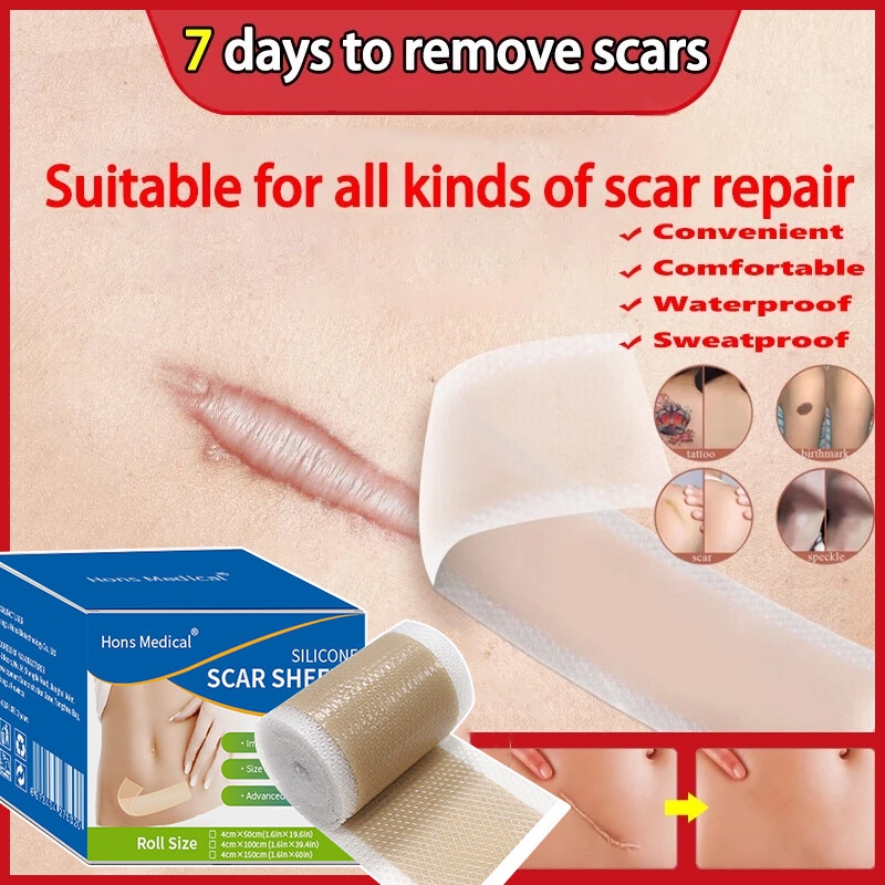 Scar Removal Medical Silicone Scar Sheet 4cmx50cm Scar Gel/Keloid Scar Plaster/Scar Removal ...