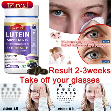 Trorexl Blueberry Lutein Capsule Myopia prevention halal Eye Health ...