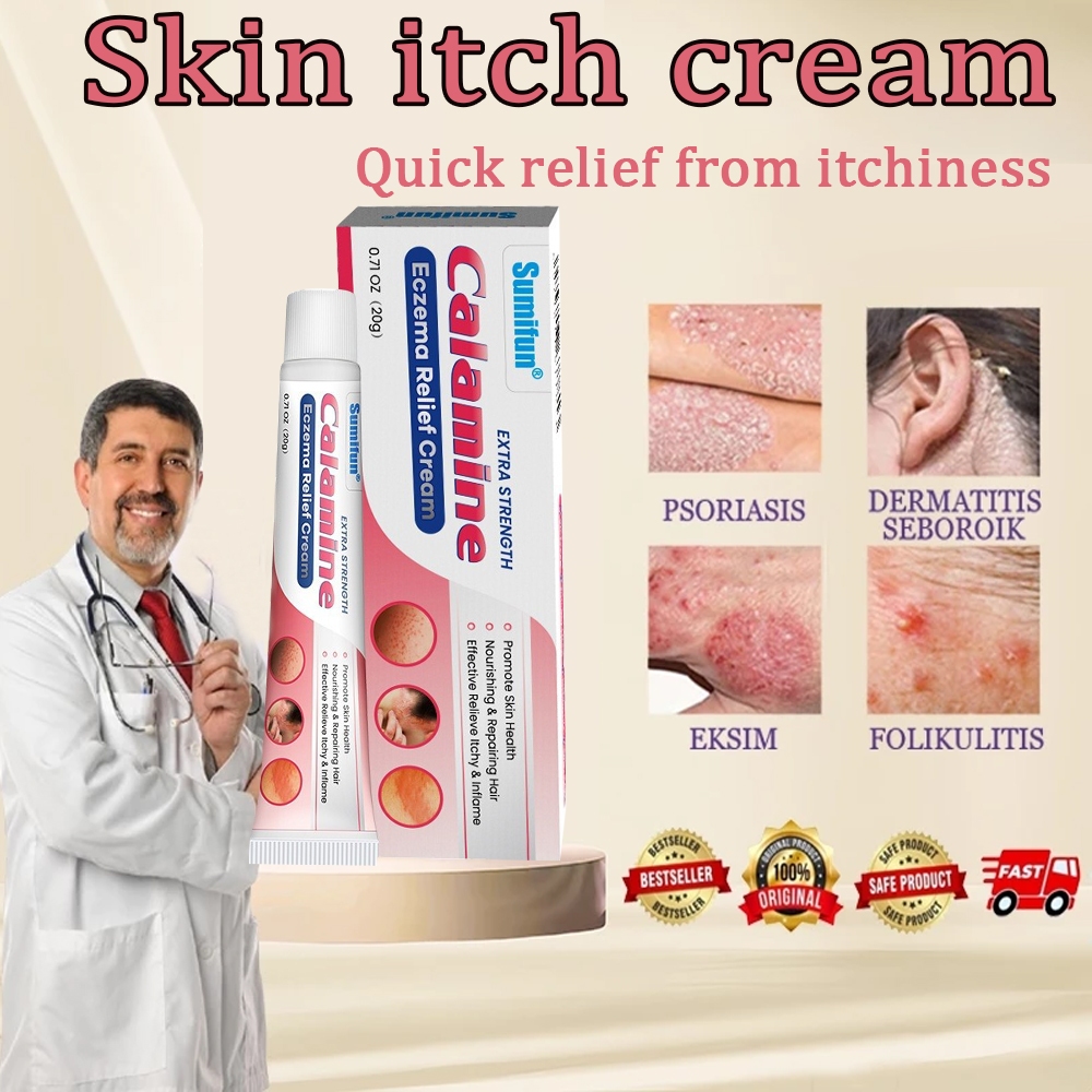 Calamine anti-itch cream 20g quick itch relief, anti-fungal, anti ...