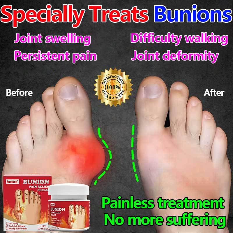 Bunion 筋骨膏 Jointment cream Gout ointment Bunion pain relief cream ...