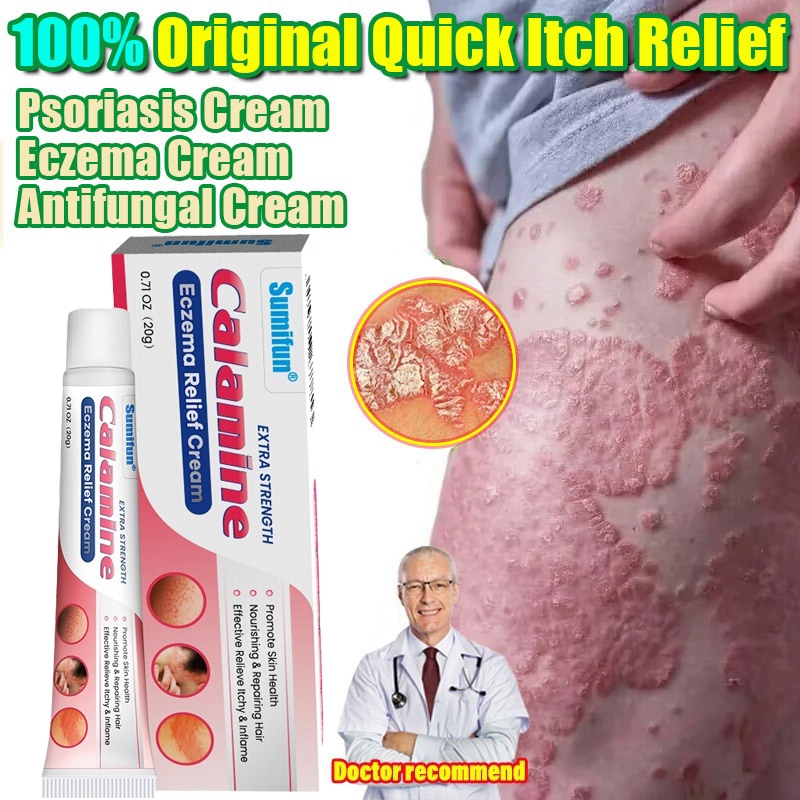 eczema cream itchy skin cream anti itch cream 20g anti-itch inhibits ...