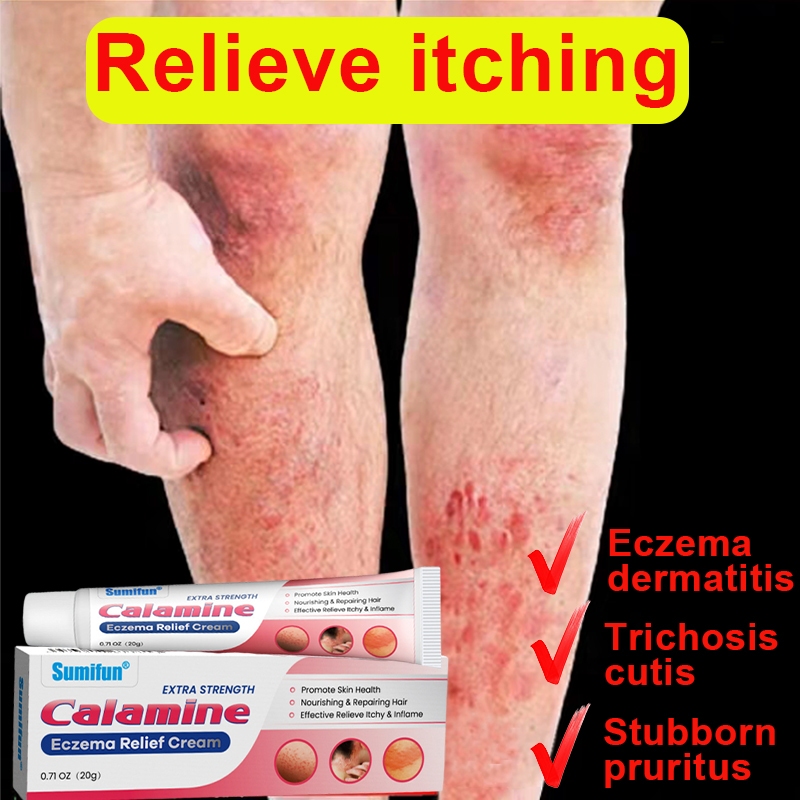 eczema cream anti-itch cream 20g antibacterial relief itchy redness psoriasis cream skin rash ...