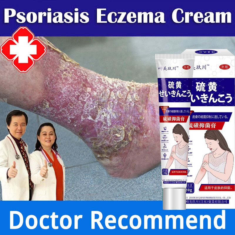 Japan antifungal cream eczema cream itchy skin cream Ointment For Itchy Skin Quick Relief ...