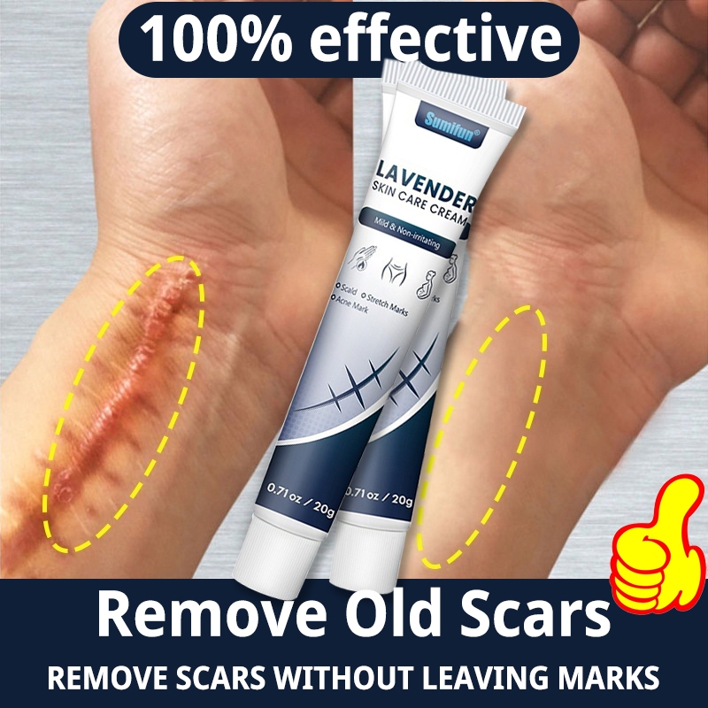 Lavender scar removal cream scars repair cream acne scars treatment 20g ...