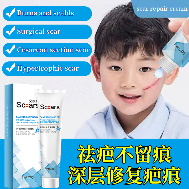 SCOARS scar gel 20g pregnancy burn laparotomy facial raised scar ...