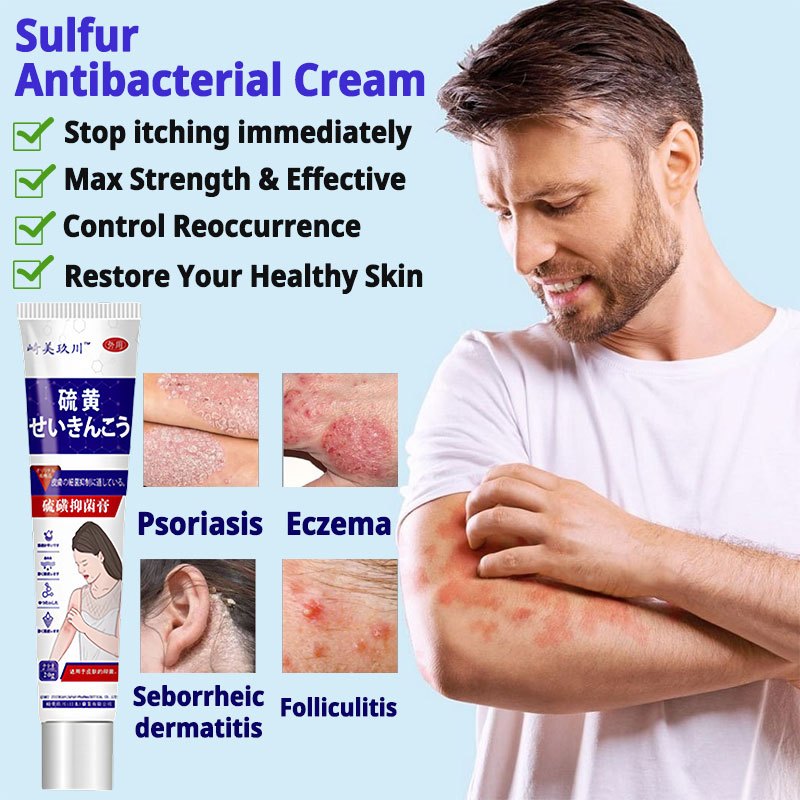 eczema cream anti itch cream antifungal cream psoriasis cream 20g Herbal formula to repair skin ...