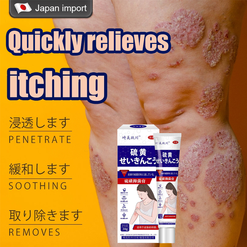 Anti Itch Cream, Eczema Intensive Healing Lotion,Psoriasis Anti-Itch ...