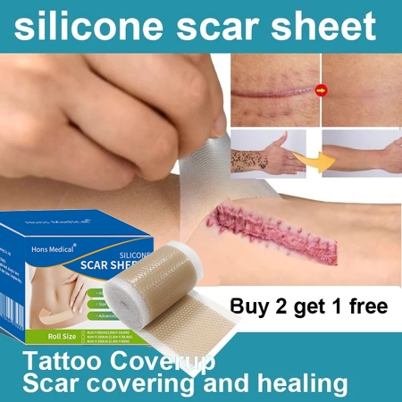 Scar Removal Medical Silicone Scar 4cmx50cm Sheet Softening And ...