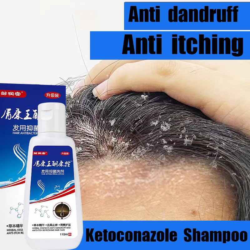 Ketoconazole Anti dandruff Shampoo 110ml Seborrheic Dermatitis ...
