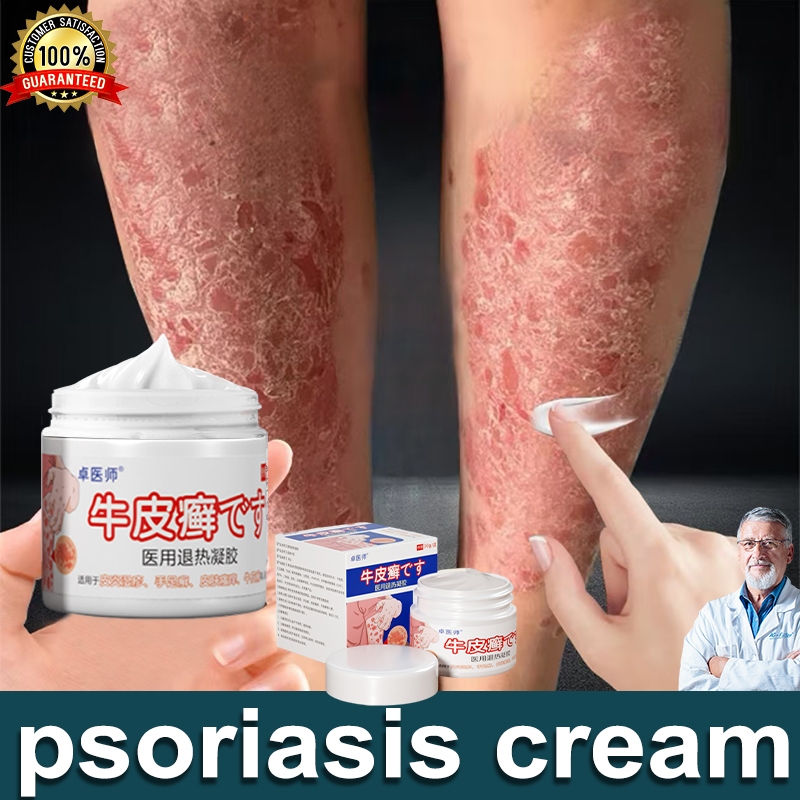 Psoriasis cream Eczema cream Antifungal cream 30g Herbal antibacterial ...