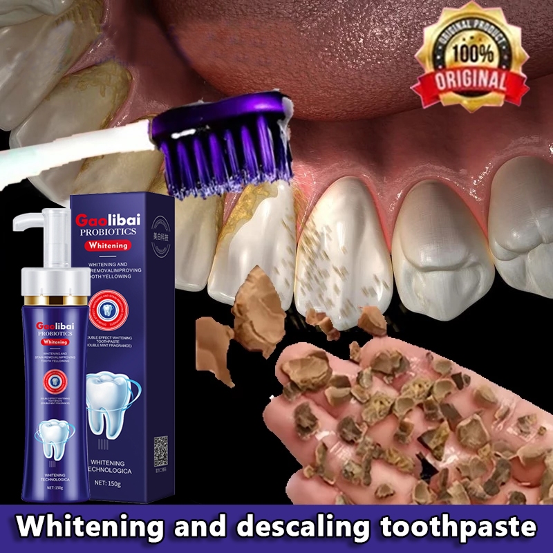 Probiotic toothpaste, Solve tooth stains, yellow teeth, tartar, tooth ...