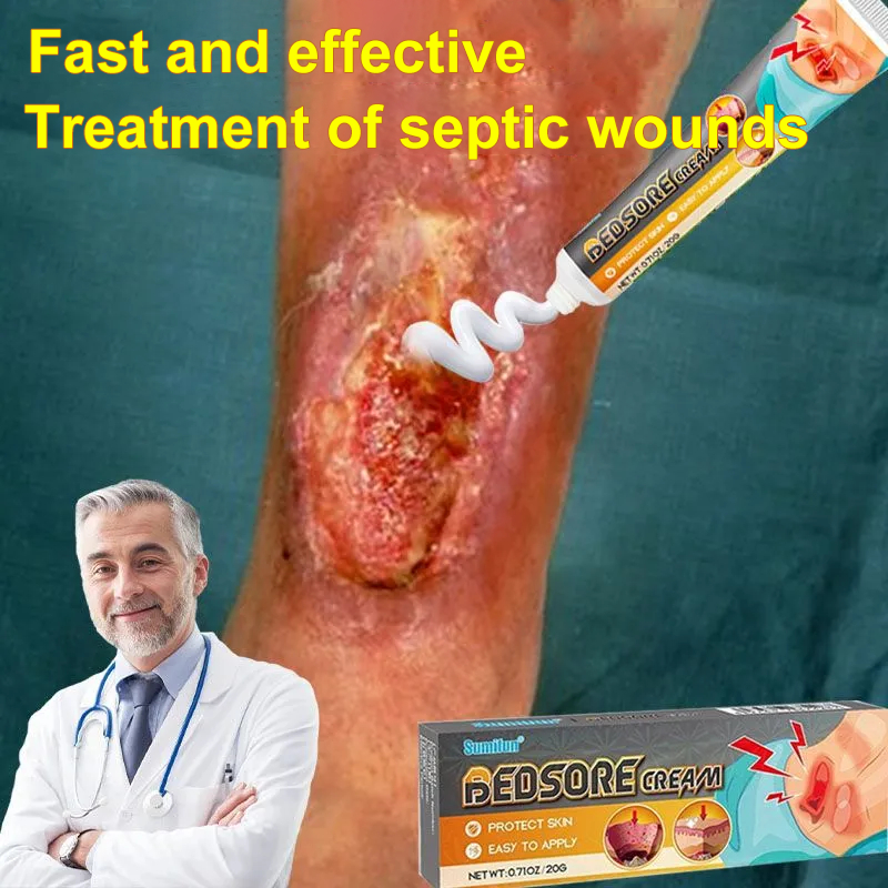 Bedsore Treatment Cream 20g Pressure Sore Ulcer Skin Rot Necrotic ...