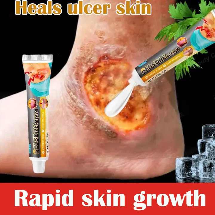 Decubitus Cream/Wound Healing/Ressure Sore Ulcer 20g Rapid treatment of ...
