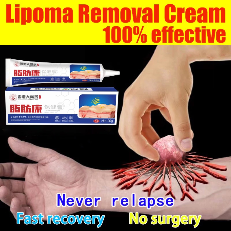 Lipoma Cream 20g Lipoma Removal Cream Removing Painless Lumps in the ...