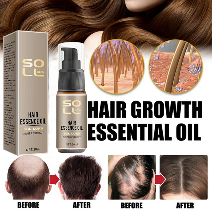 SOLLORA Hair Growth Serum Fast Hair Growth Spray Hair & Scalp ...