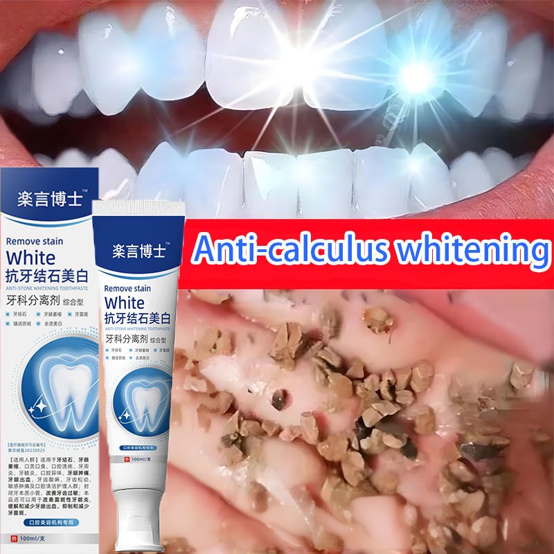 Anti-calculus toothpaste 100ml whitening toothpaste Oral & Dental ...