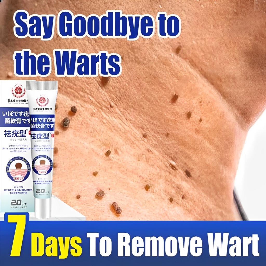Wart Removal Cream 20g Skin tag remover-mole removal-Flat warts ...