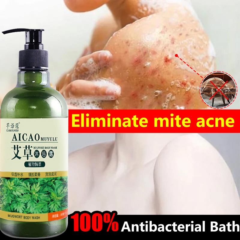 Original Acne Body Wash Anti-mite and anti-itch Moisturizing and whitening 500ML | Shopee Singapore