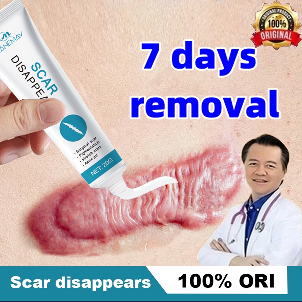 20g fast scar removal cream, suitable for burn scars, hyperplastic ...
