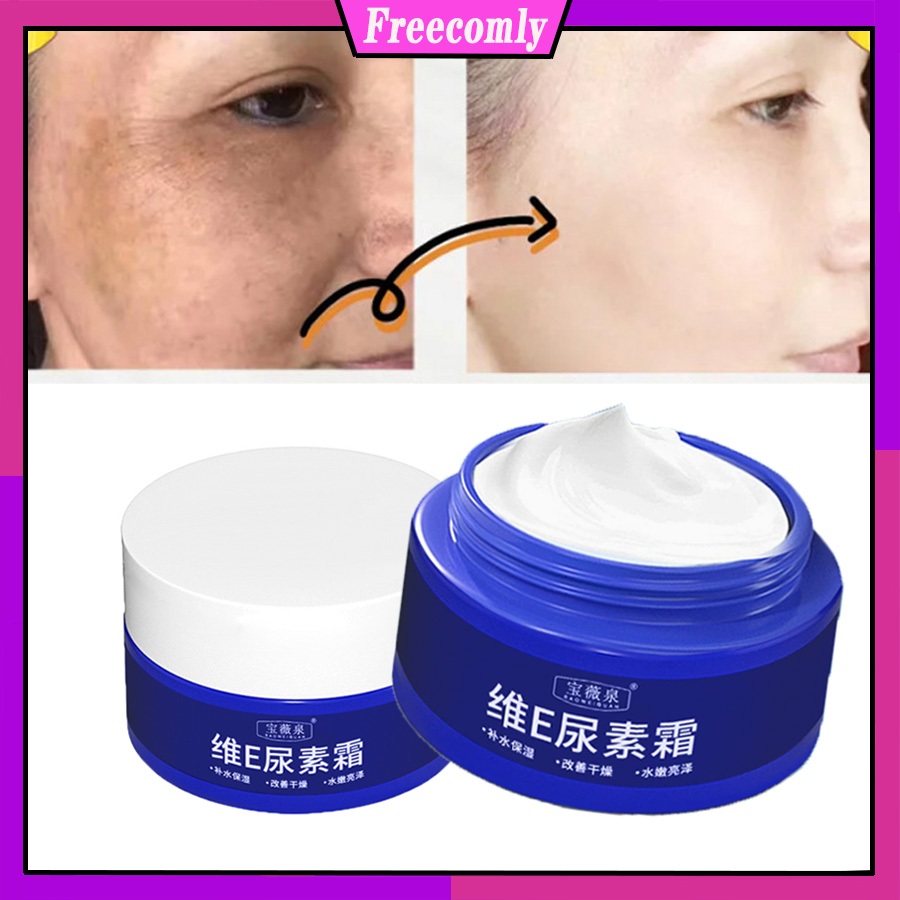 Yellow Spots Disappear Spot Fading Vitamin E Urea Cream Hydrating Blemish Essence Improve ...
