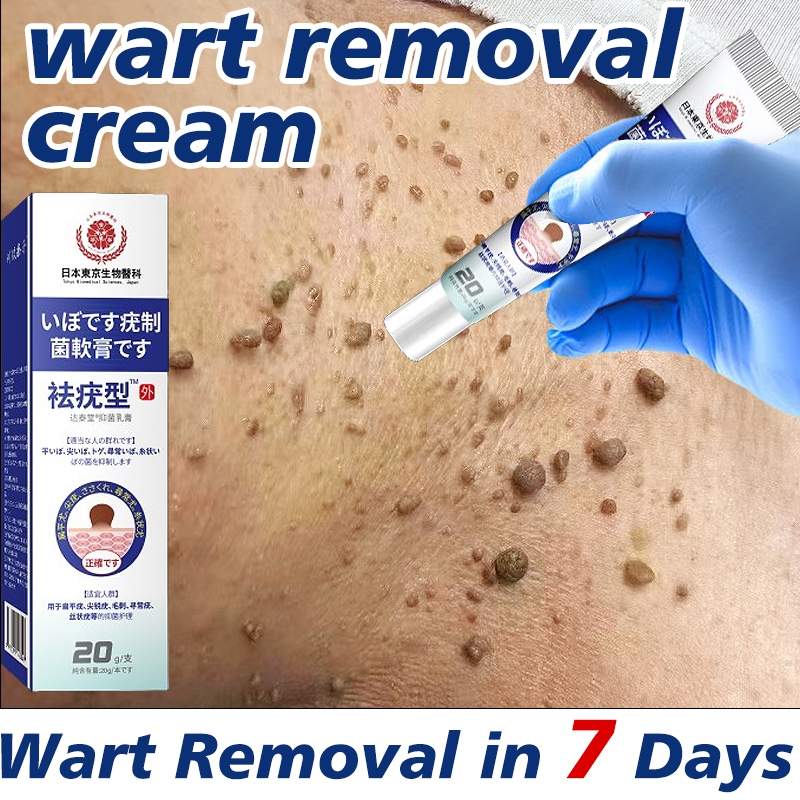 Warts Removal Skin Tag Remover 20g Wart Removal Cream 7 Days Effective ...