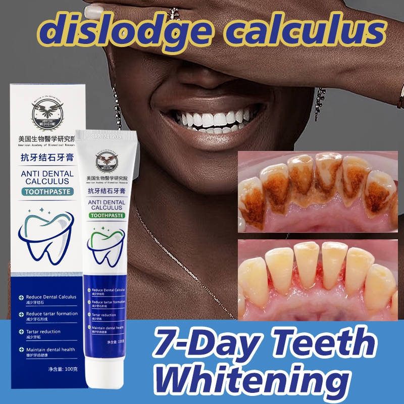 Whitening Toothpaste teeth whitening 100g teeth stain remover Removal ...