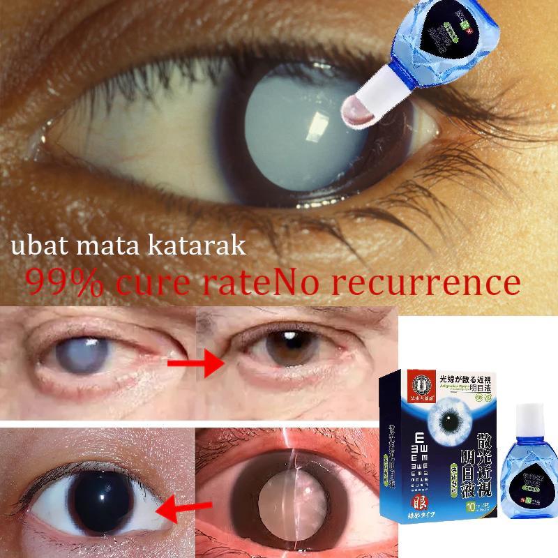 Eye drop japan Obat mata katarak Dry eyes drops Ubat mata selaput Ubat ...
