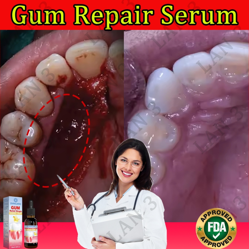 gum repair gum instant soothing gel gum recession therapy inflammation ...
