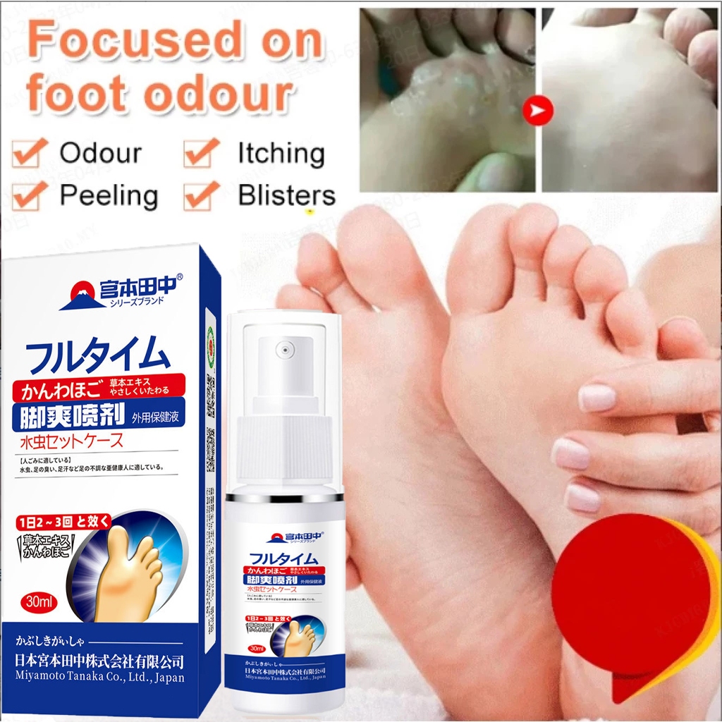Athlete's foot spray to relieve itching, peeling and sterilization ...