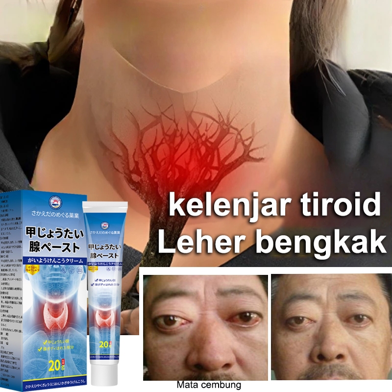 Thyroid cream Thyroid nodule ointment Thyroid mass elimination cream ...