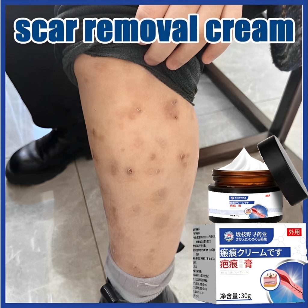 【Japan】Scar removal cream 30g removes black scars/acne scar removal ...