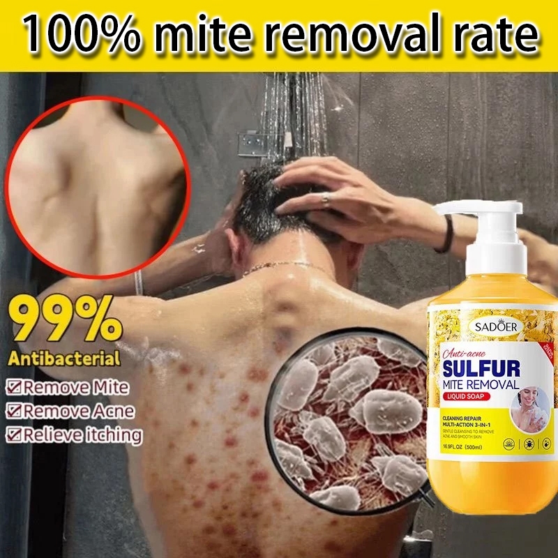 Acne Clear Body Wash Antibacterial Body Wash 500ml Sulfur Anti-mite and anti-itch shower gel ...
