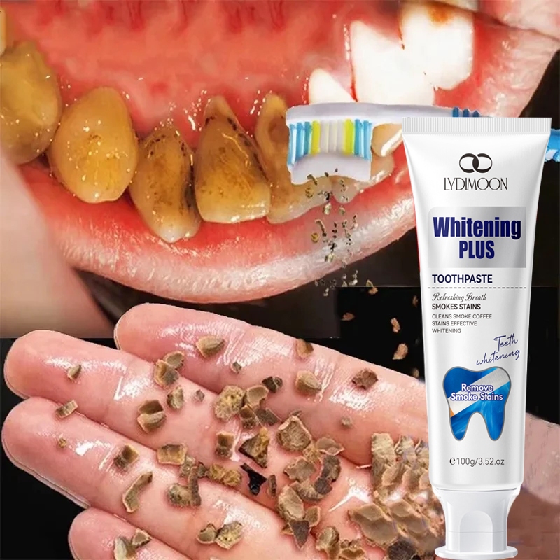 Plaque Removal Tartar Whitening Toothpaste Teeth Whitening Probiotic ...