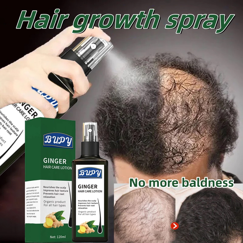 Hair growth spray Fast Hair Growth Anti Hair Loss Serum 120ml Natural ...